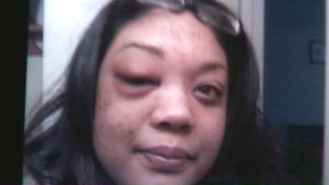 Patient Attacks Have Hospital Workers Concerned | Fox News Video